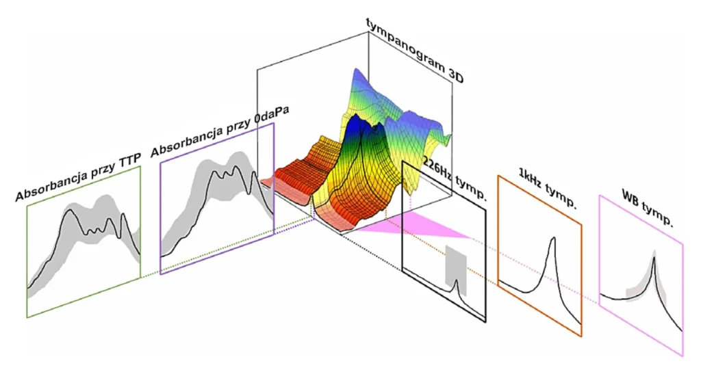 Tympanometria szerokopasmowa - Marmed